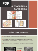 Protocolo FAST y líquido abdominal | PDF | Ultrasonido médico | Pelvis