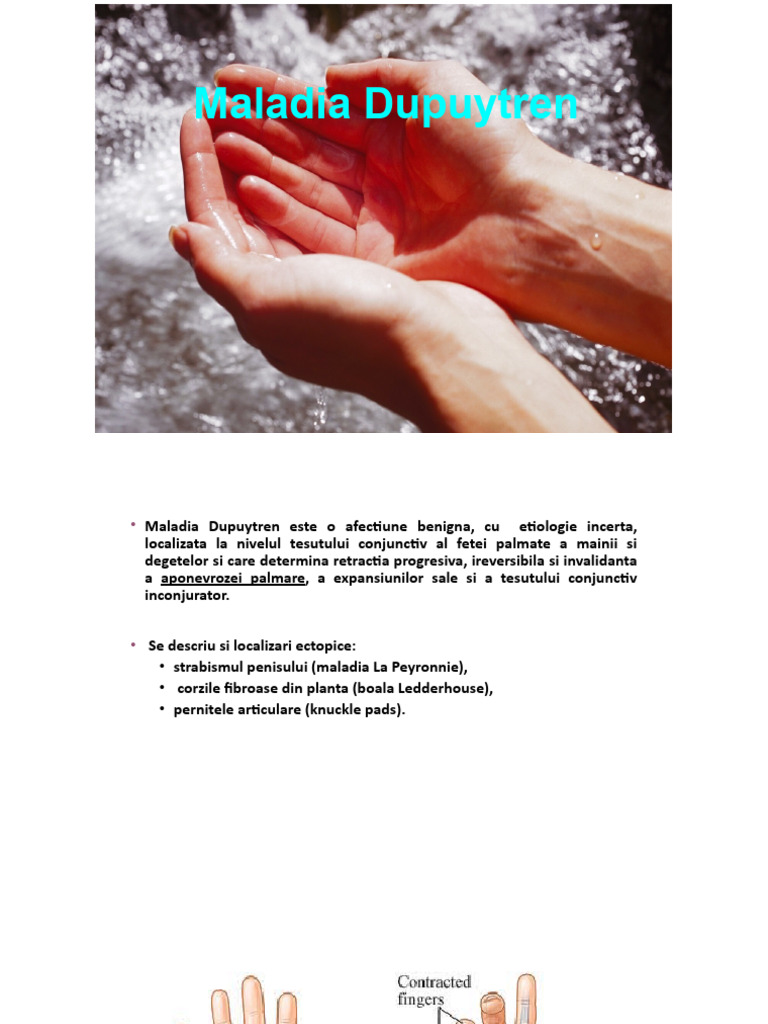 Maladia Dupuytren 21 | PDF