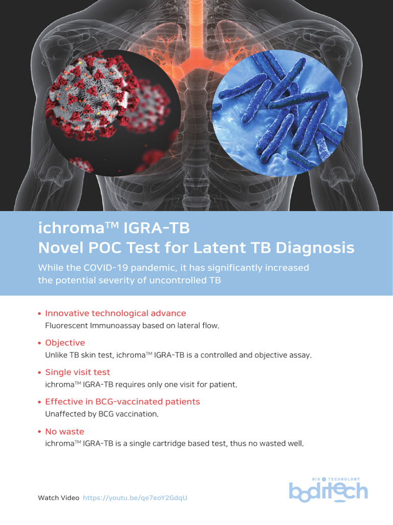 IGRA | Download Free PDF | Tuberculosis | Medical Specialties