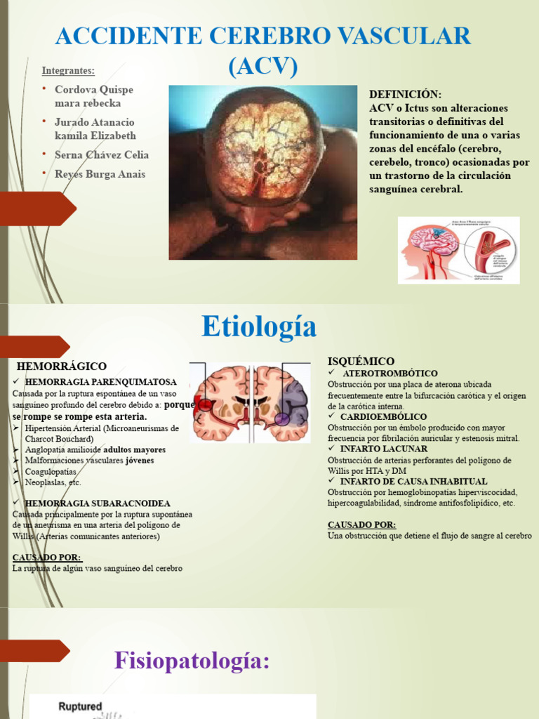 Accidente Cerebro Vascular (ACV) ... | PDF | Carrera | Medicina