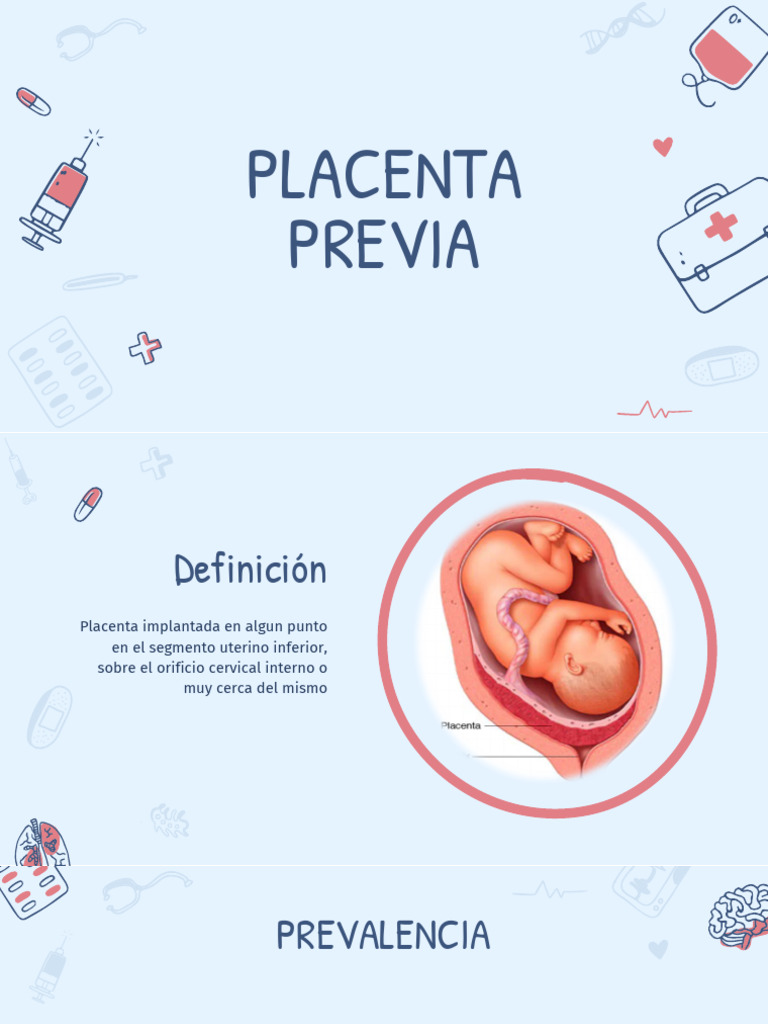 Placenta Previa: Diagnóstico y Manejo | PDF | Embarazo humano ...