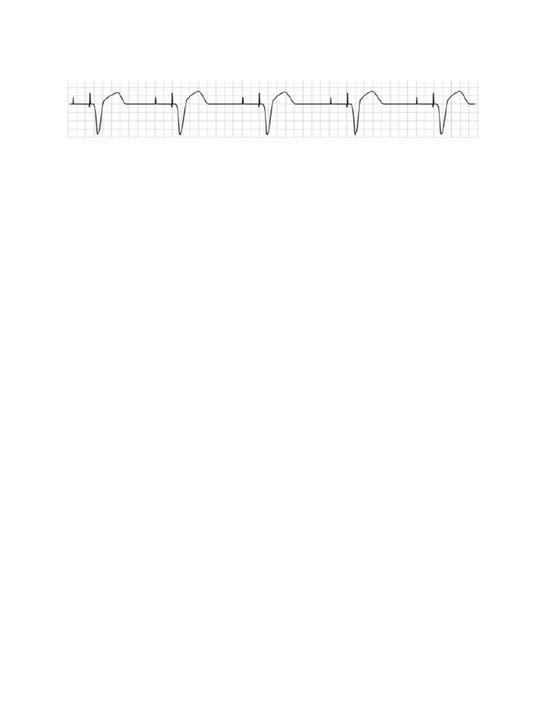 Failure Capture | PDF