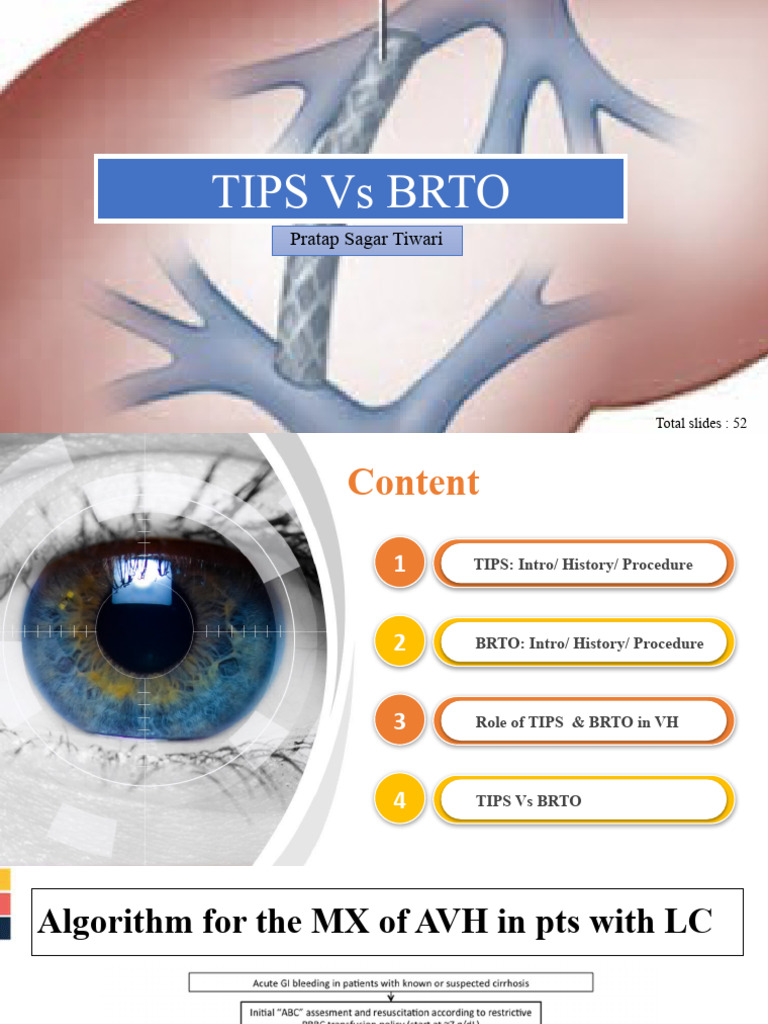 Tips Vs Brto | PDF | Liver | Cardiovascular System