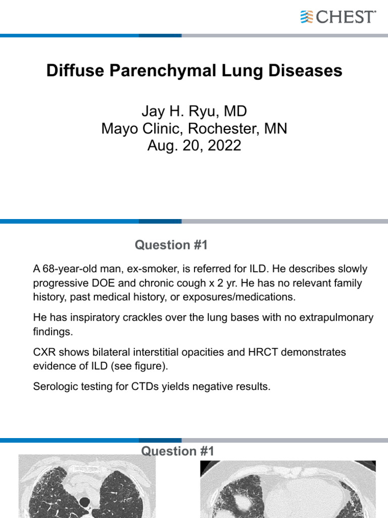 8 Diffuse Parenchymal Lung Diseases Live Session Recording | PDF ...
