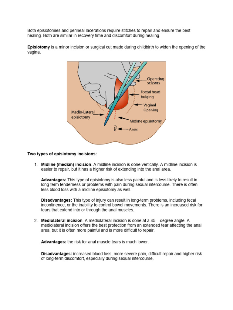 Epsiotomy | PDF | Childbirth | Medical Specialties