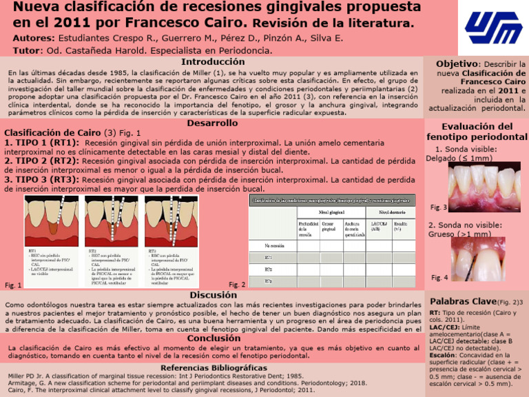 Clasificación de Cairo - Póster Periodoncia - Horizontal - 3c | PDF ...