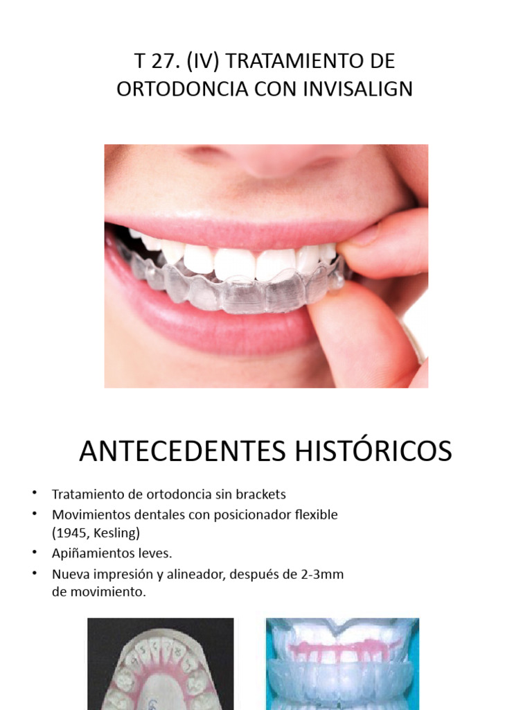 Tratamiento de Ortodoncia con Invisalign | PDF