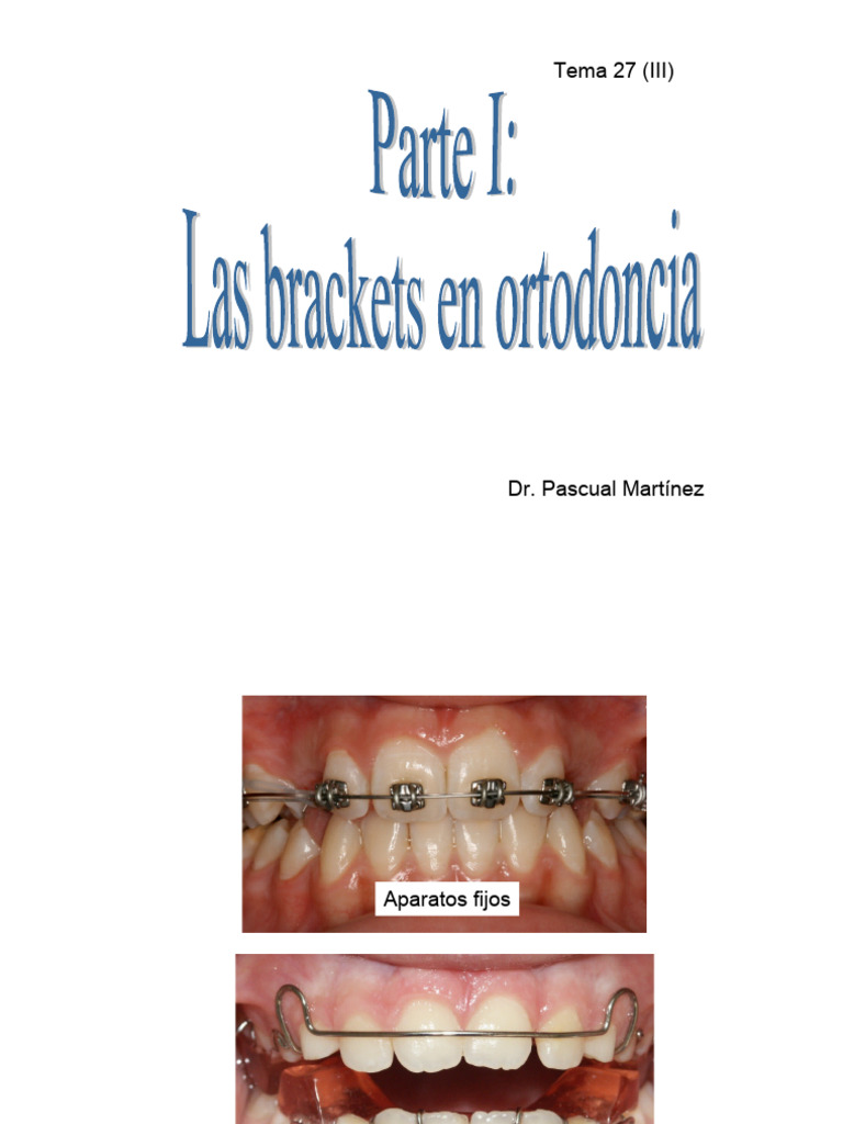 Guía Completa de Brackets en Ortodoncia | PDF | Ortodoncia | Bienes ...