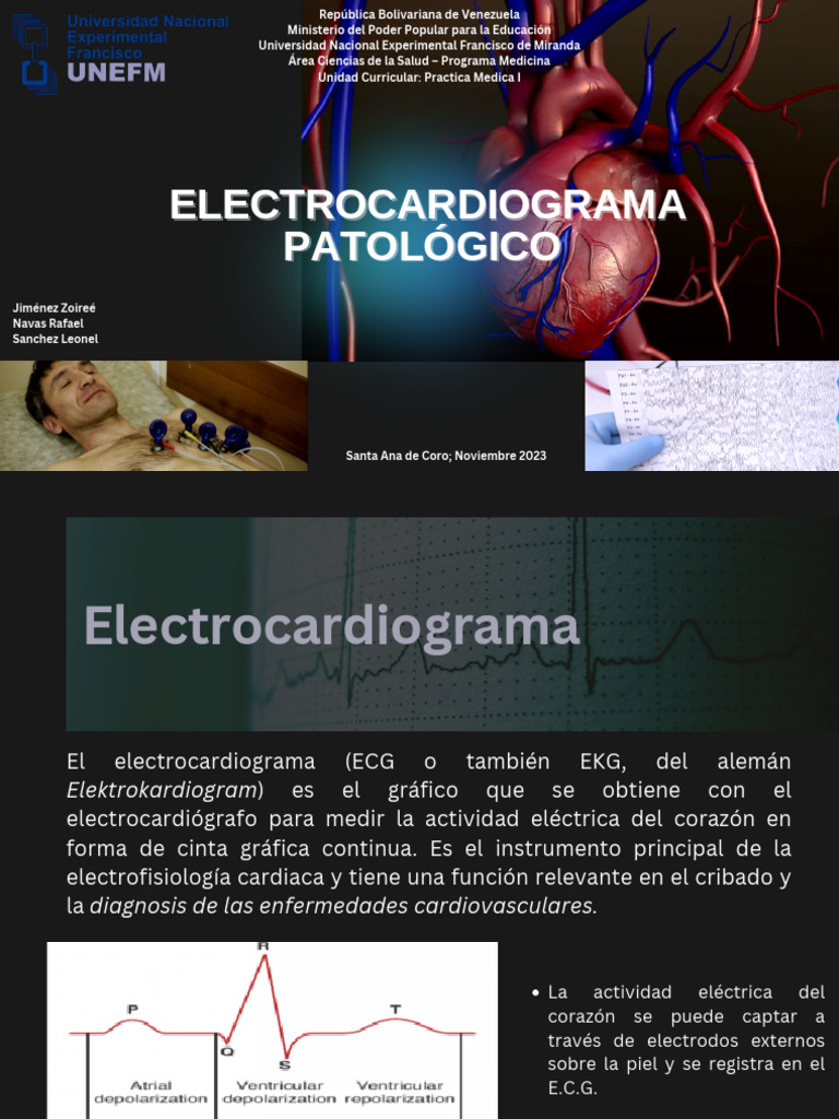 Pm. Ecg Patológico | PDF | Electrocardiografia | Medicina CLINICA
