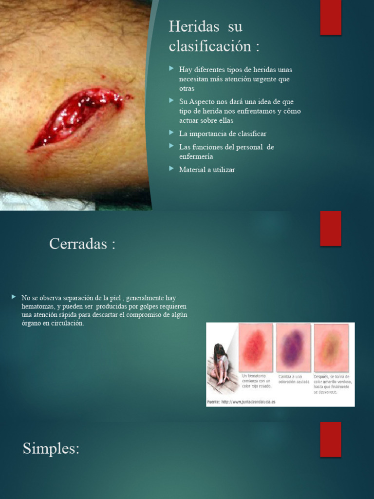 Clasificacion de Heridas | PDF | Herida | Enfermería