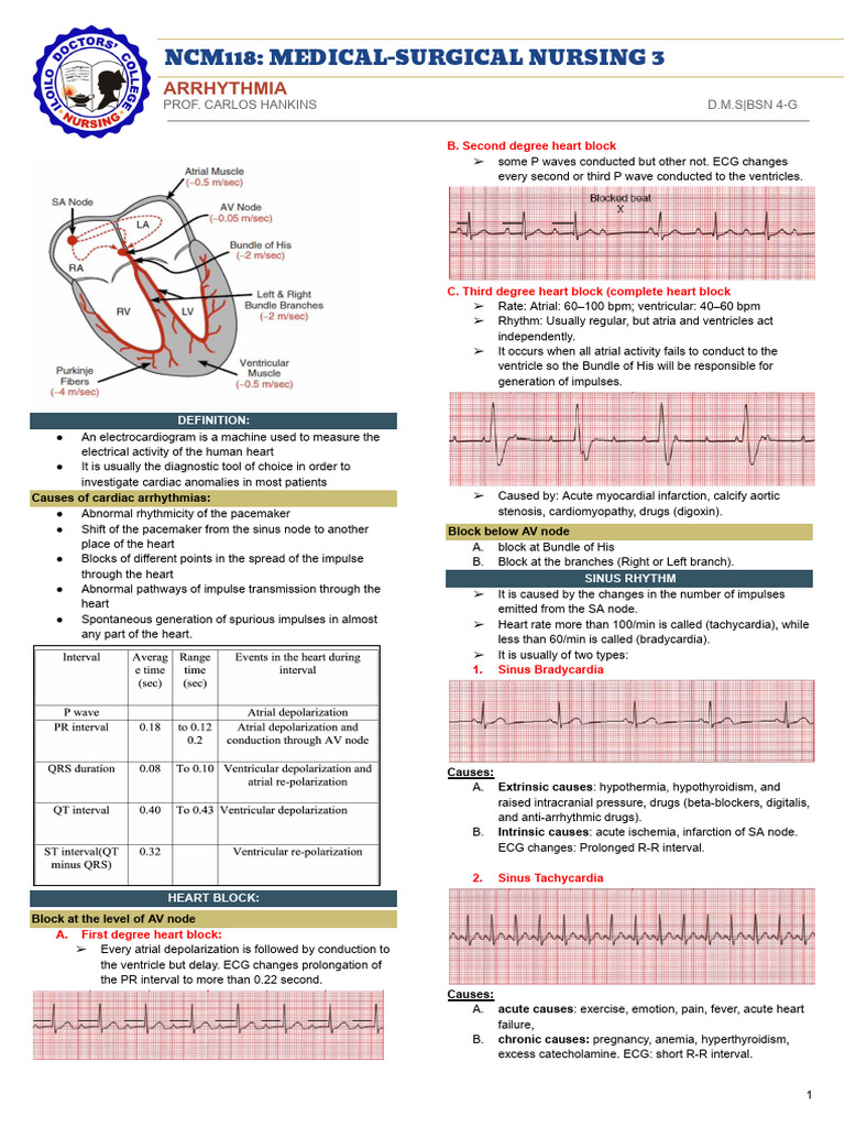MT MS Arrythmia | Download Free PDF | Heart | Electrocardiography