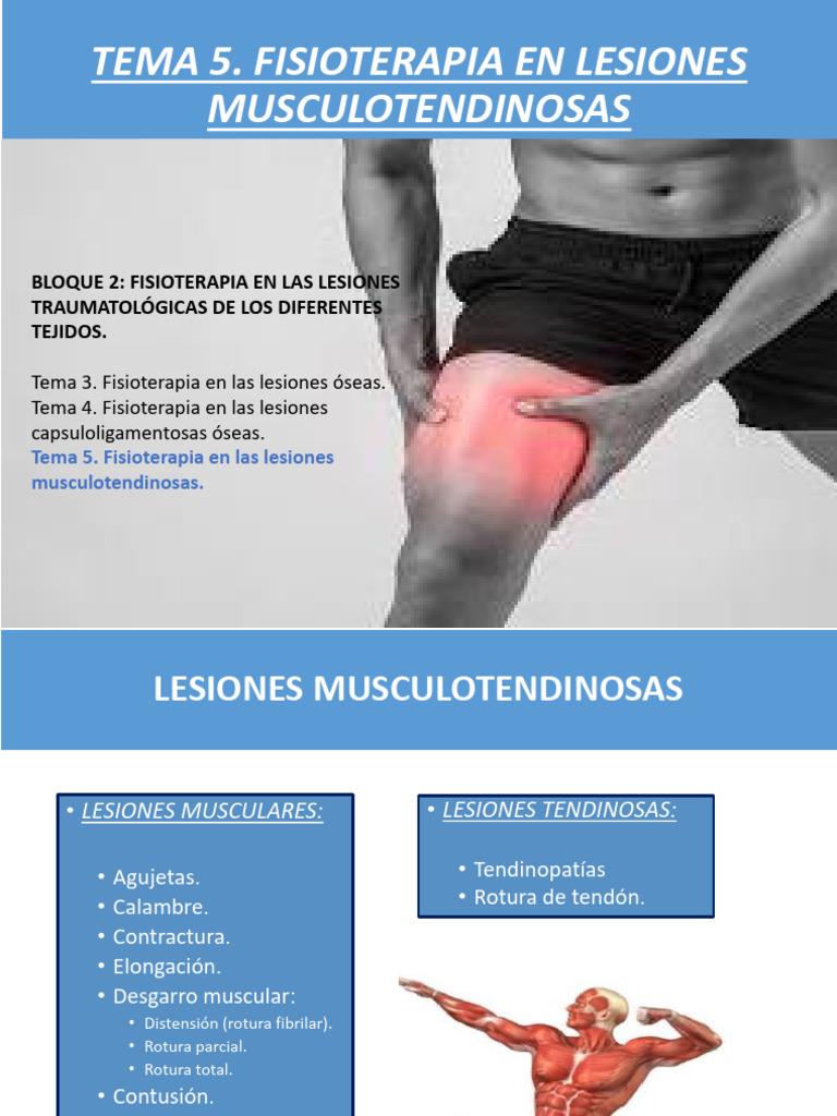 Tema 5. Lesiones Musculotendinosas. | PDF | Tendón | Medicina CLINICA