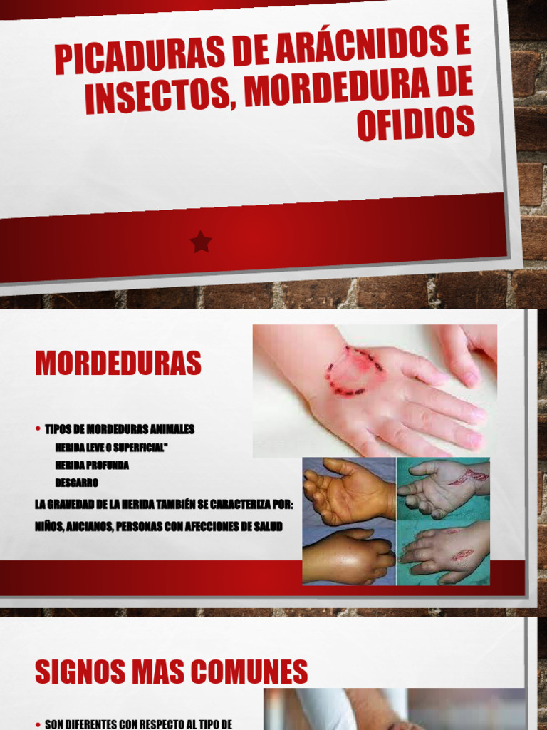 Manejo de Mordeduras y Picaduras Animales | PDF | Medicina CLINICA ...
