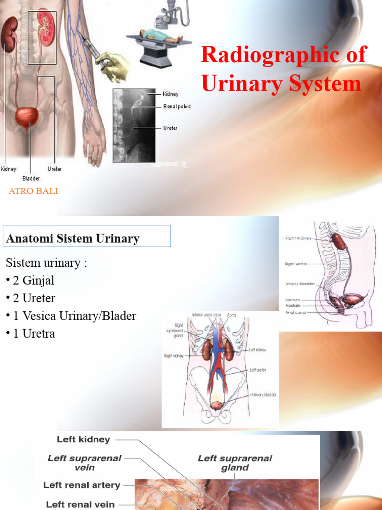 Radiographic of Urinary System Edit 2 | PDF