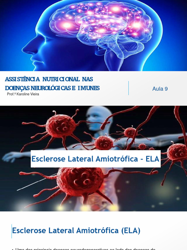 Aula+9+ +Esclerose+Lateral+Amiotr%C3%B3ifica%2C+Artrite+Reumat%C3%B3ide ...