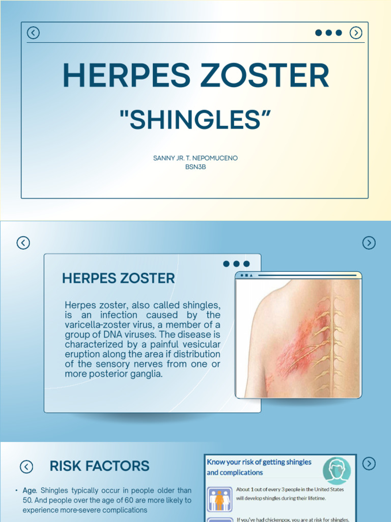 Herpes Zoster | PDF
