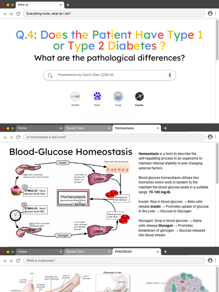 Sklay | PDF | Diabetes | Insulin Resistance