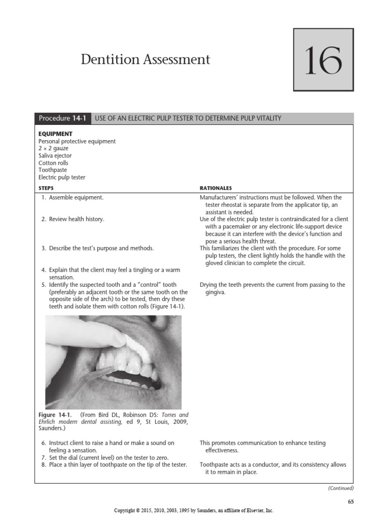 Use of an Electric Pulp Tester | PDF | Tooth | Dentistry Branches