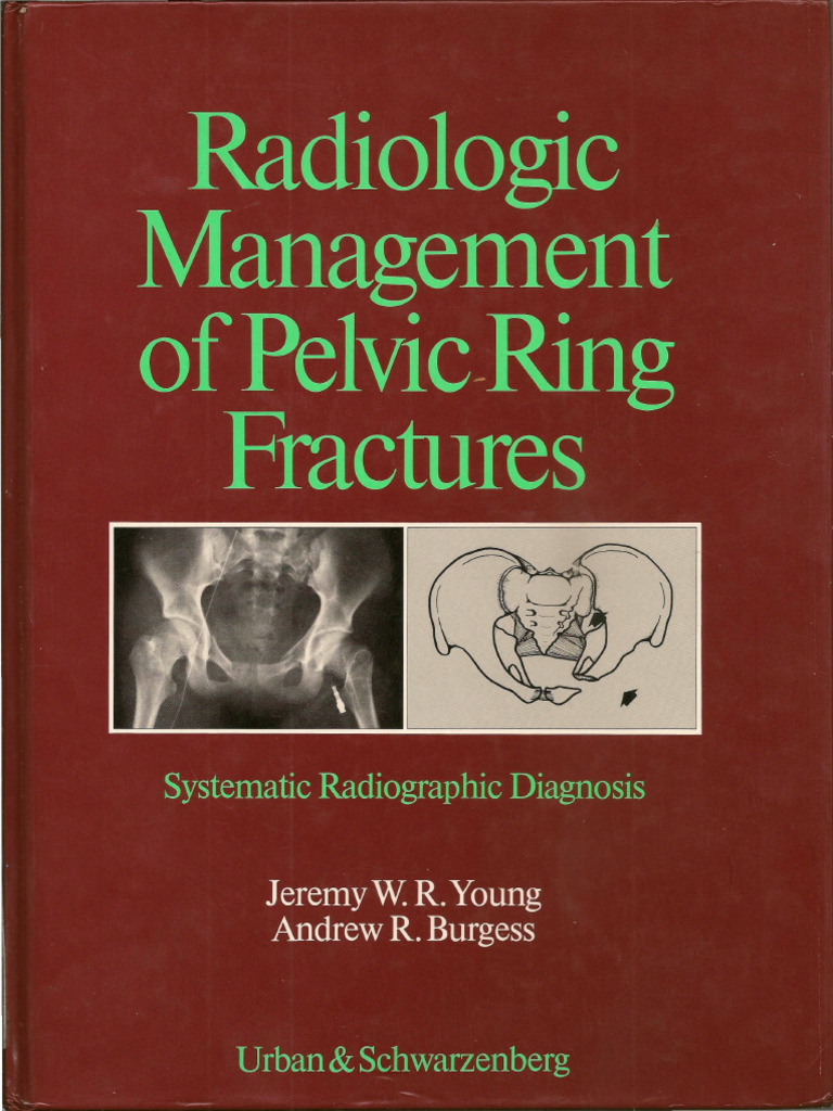 Radiologic Management of Pelvic Ring Fractures | PDF | Pelvis | Skeletal System