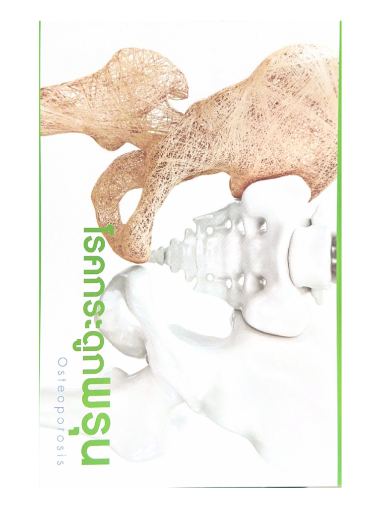 OSTA (Osteoporosis Self-Assessment Tool For Asians) ® | PDF