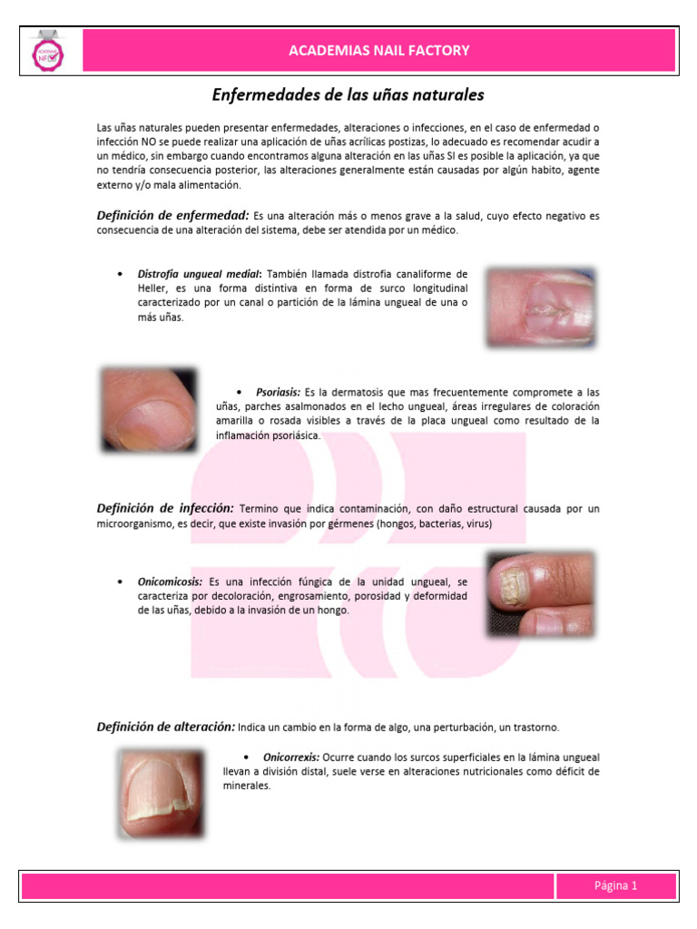 Enfermedades de Uñas Naturales y Alteraciones | PDF | Clavo (anatomía ...