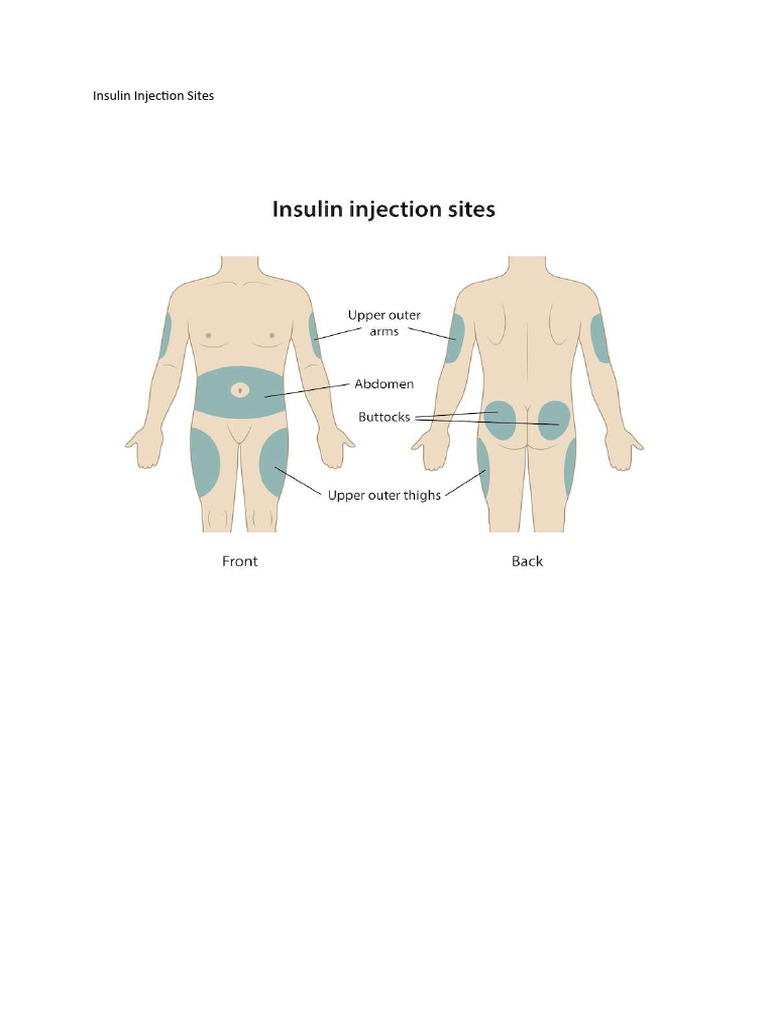 Insulin Injection Sites | PDF
