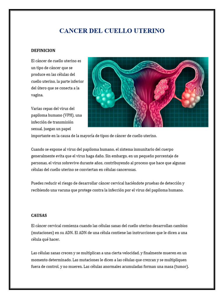 CANCER DE CUELLO UTERINO Listo | Descargar gratis PDF | Cáncer | Quimioterapia