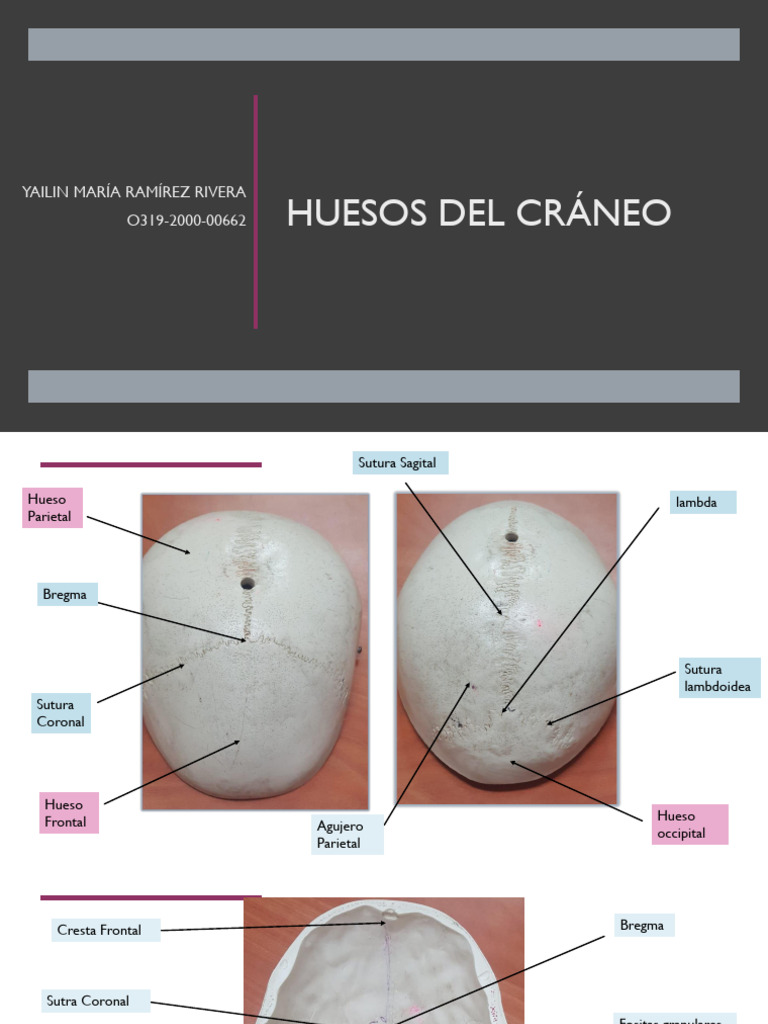 Huesos Del Craneo Pdf Sistema Musculoesquelético Cabeza Y Cuello