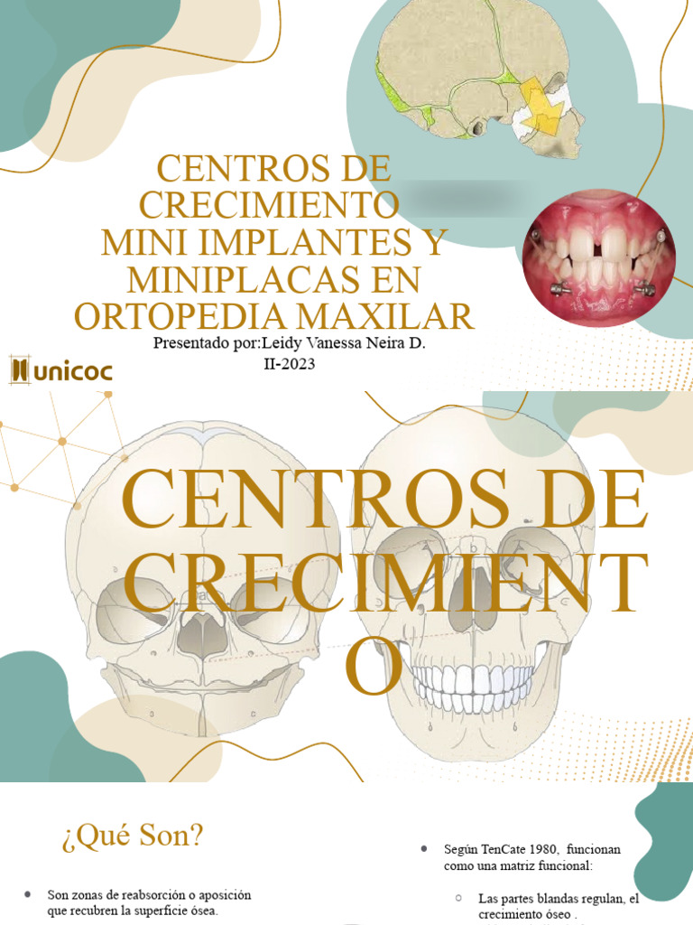 Centros de Crecimiento - Minimplantes y Miniplacas | PDF | Ortodoncia ...