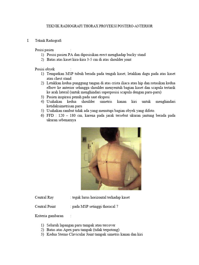 Teknik Radiografi Thorax Pa | PDF | Sains & Matematika