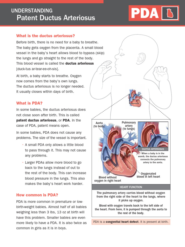RESP - Patent Ductus Arteriosus PDA Tear Pad Update | PDF | Heart | Artery