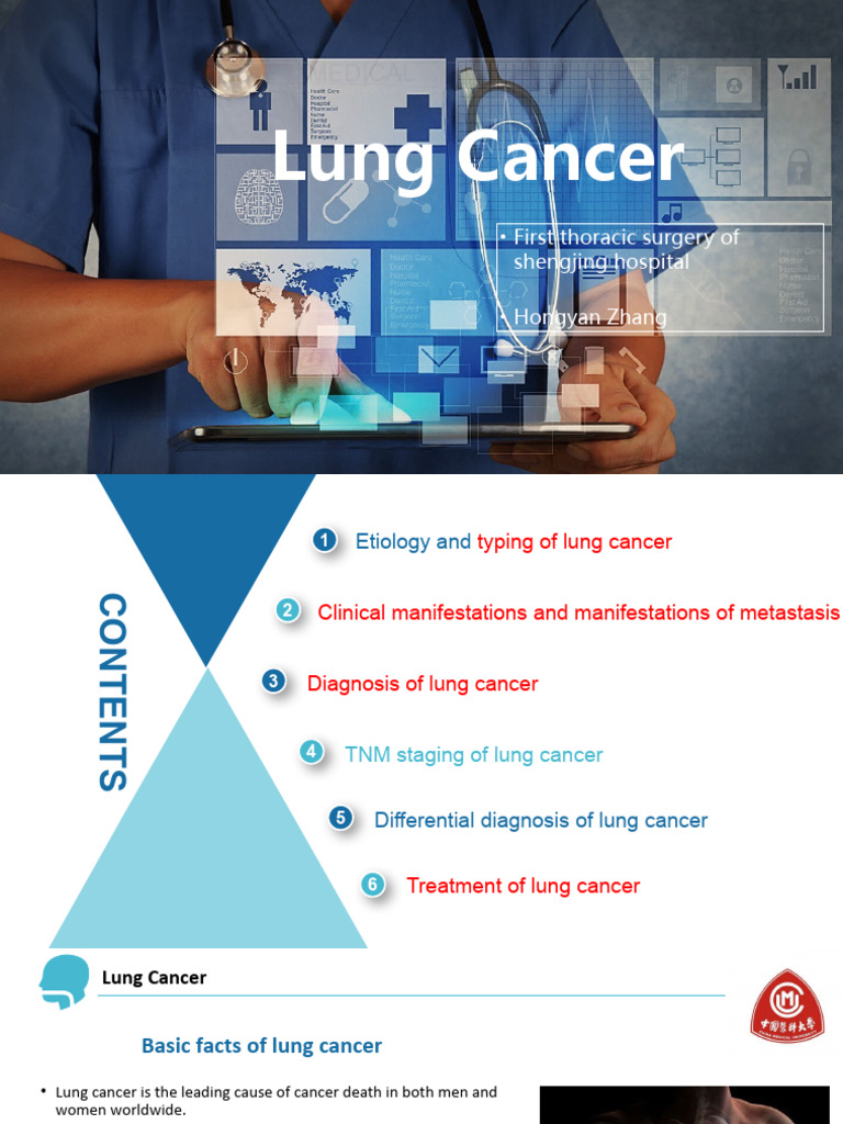 Lung Cancer | PDF | Lung Cancer | Respiratory Diseases