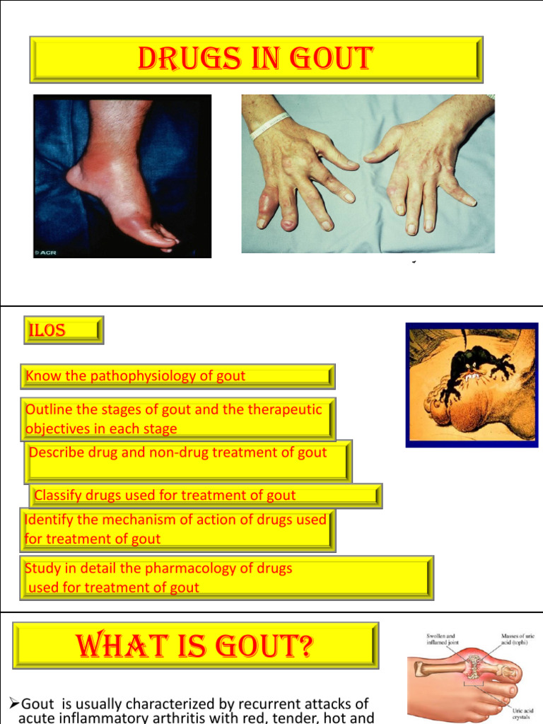 5 - Drugs Used For Treatment of Gout Edited | PDF | Gout | Human ...
