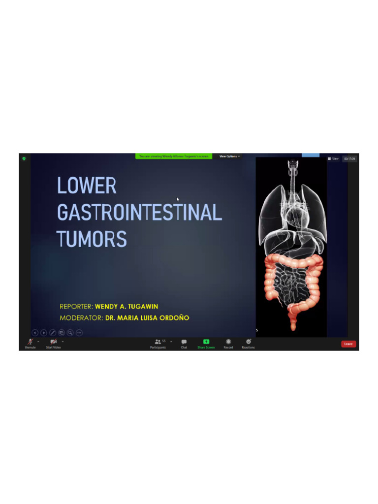 5 - Lower GI Tumors | PDF