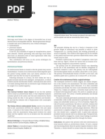 Dialysis Fistula Handout Accessible FA | PDF | Hemodialysis | Medical ...