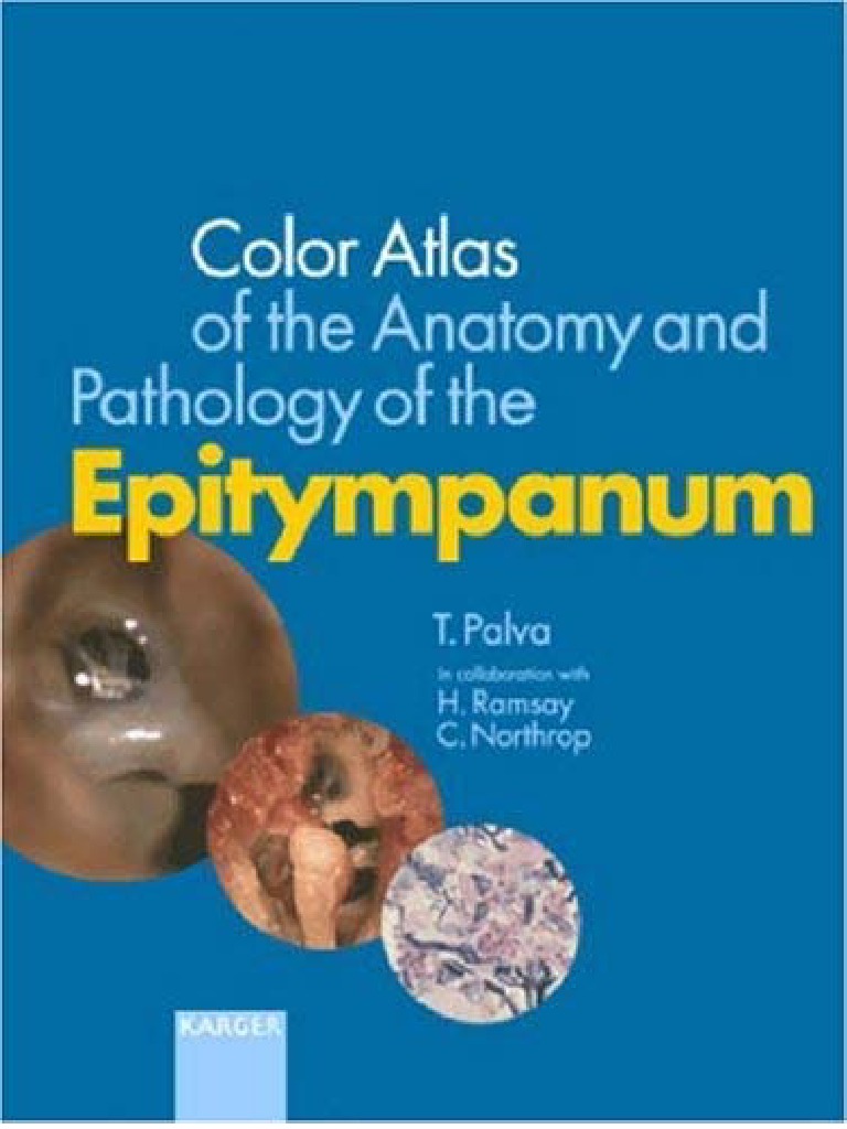 Colour Atlas of The Anatomy and Pathology of The Epitympanum ...