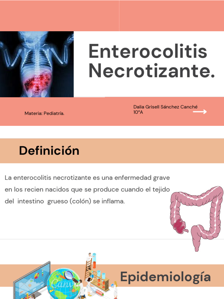 Enterocolitis Necrotizante. - 20240210 - 171951 - 0000 | PDF ...