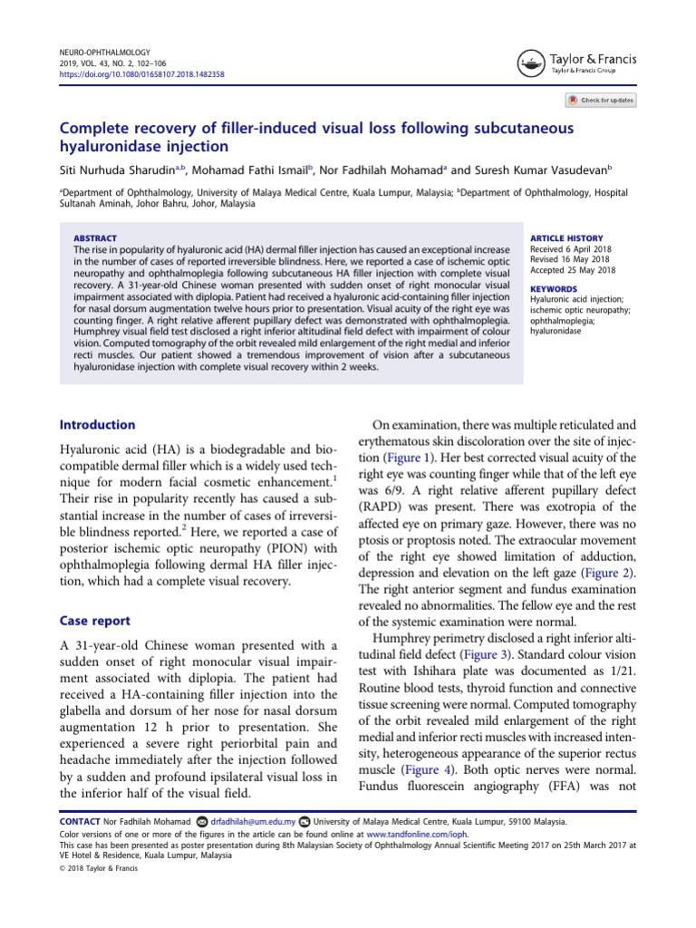 Complete Recovery of Filler-Induced Visual Loss Following Subcutaneous Hyaluronidase Injection ...