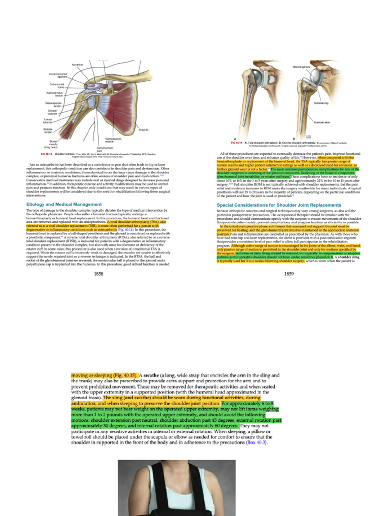 NBCOT Shoulder | PDF