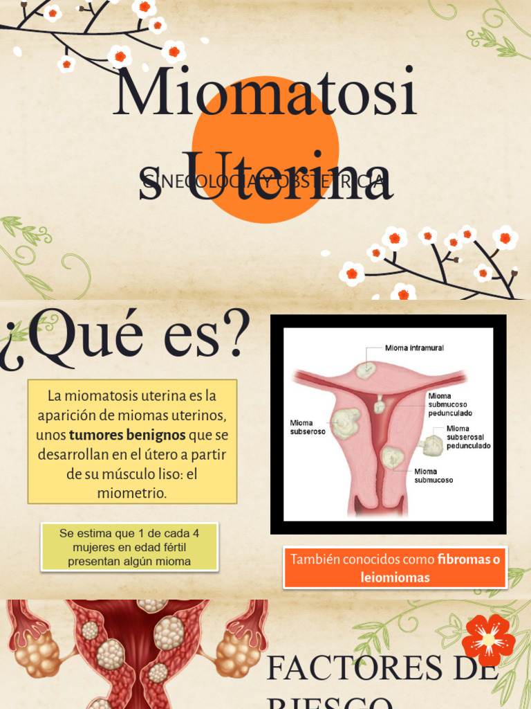 Miomatosis Uterina | PDF | El embarazo | Menstruación