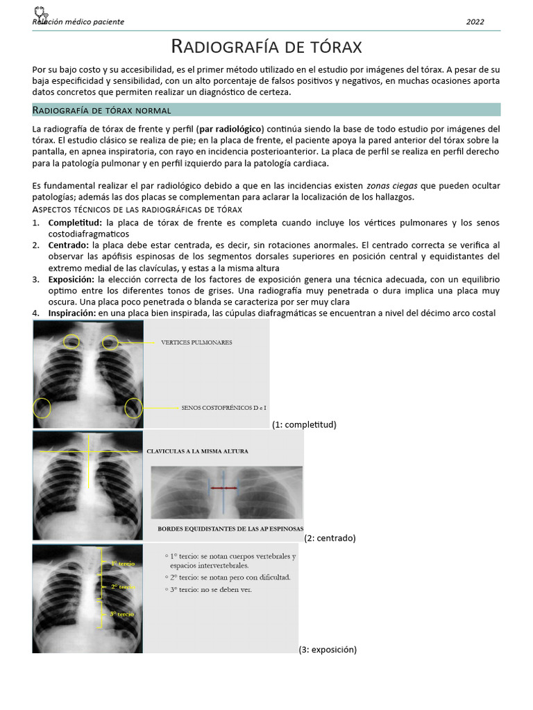 RX Torax | PDF | Pulmón | Corazón