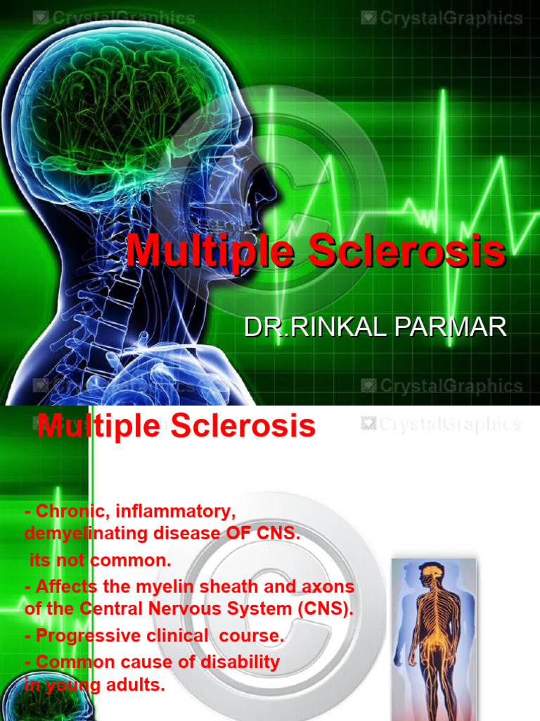 Multiple Sclerosis | PDF | Multiple Sclerosis | Myelin