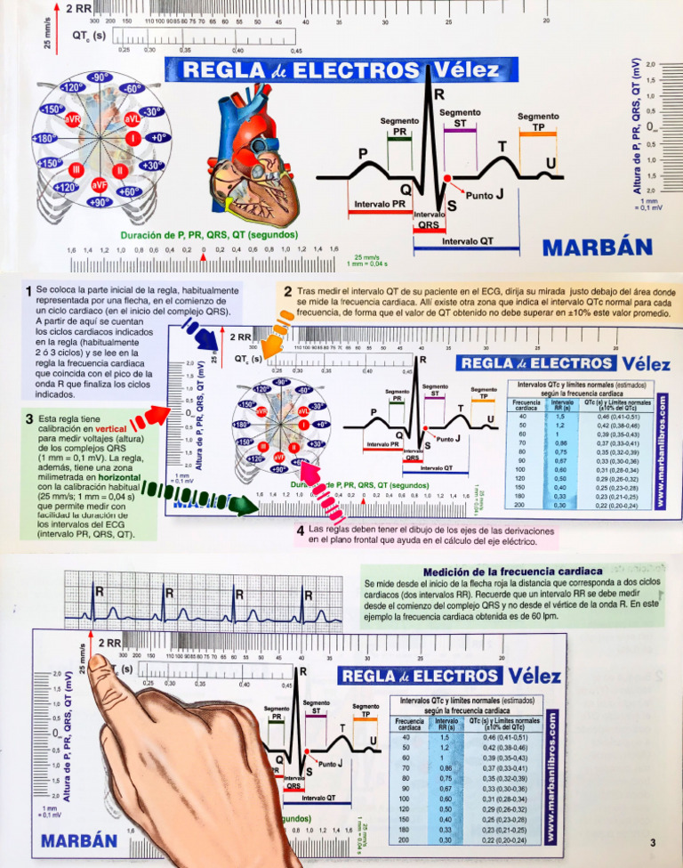 Regla de Electros Vélez | PDF