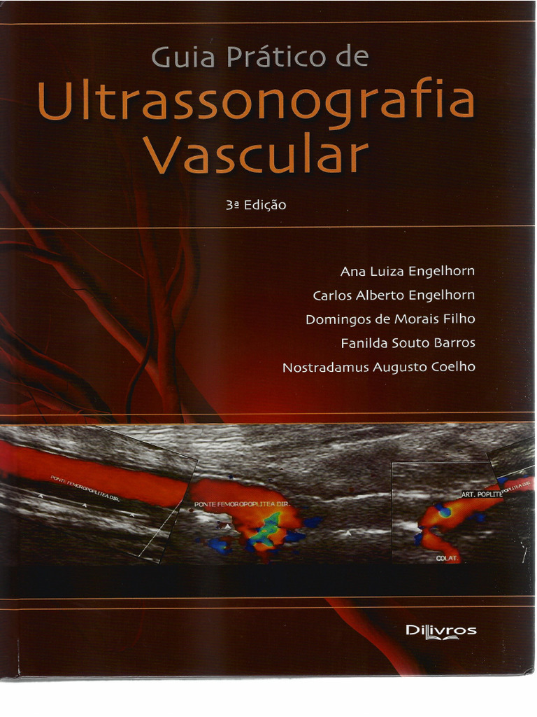 Guia Prático de US Vascular 2015 | PDF