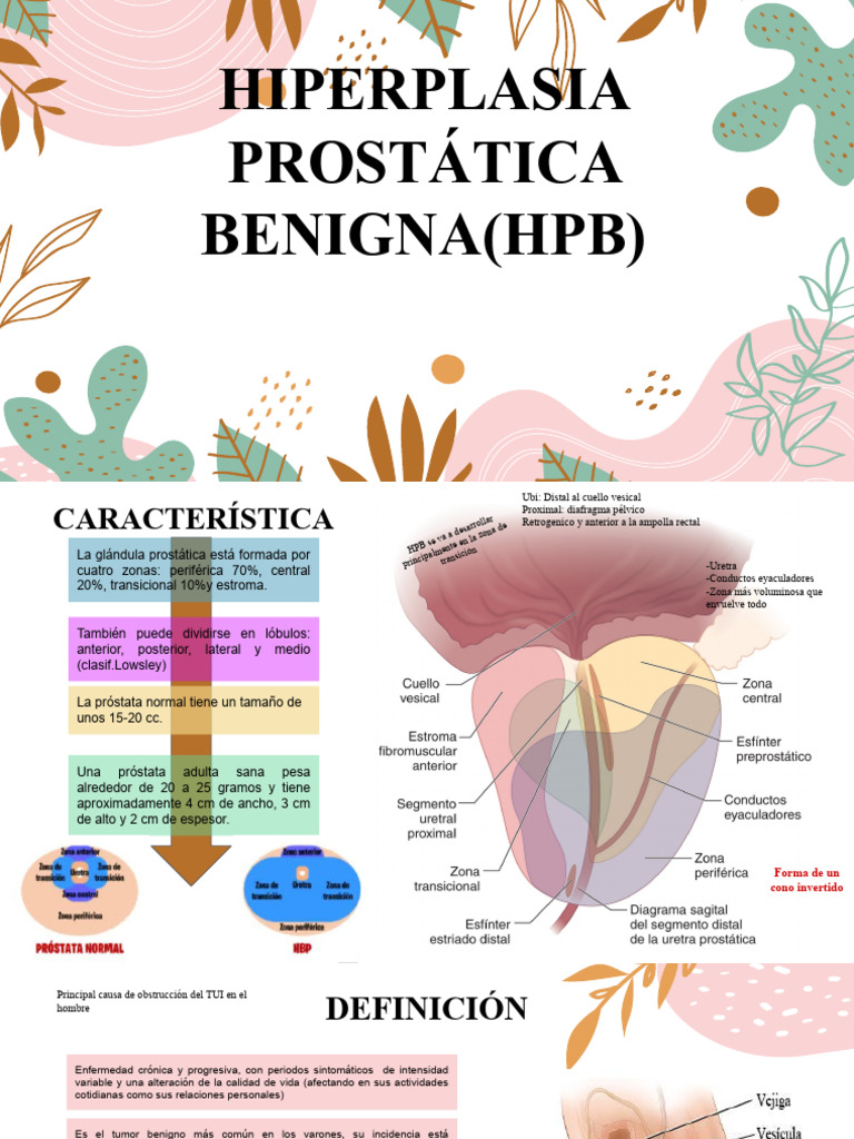 Hiperplasia Benigna Prostática | PDF | Especialidades Medicas | Medicina CLINICA