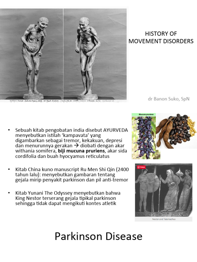 History of Movement Disorders | PDF | Parkinson's Disease | Dystonia