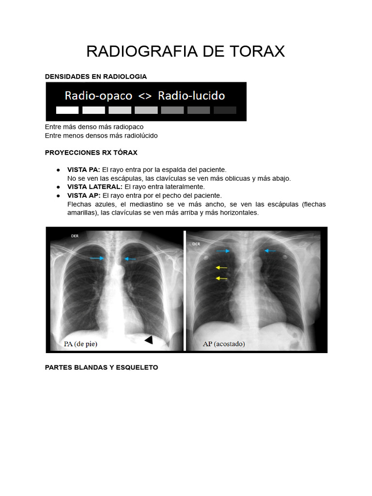 Interpretación de Radiografías de Tórax | PDF | Pulmón | Tórax