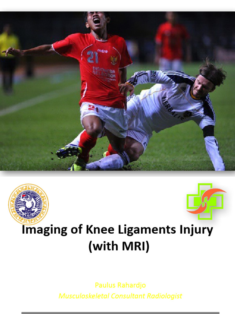 Imaging in Knee Ligament Injury | PDF | Traumatology | Joints