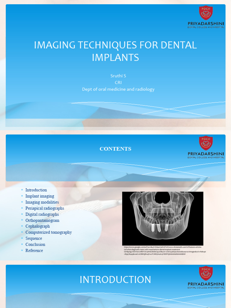 Dental Implant Imaging | PDF | Ct Scan | Medical Imaging