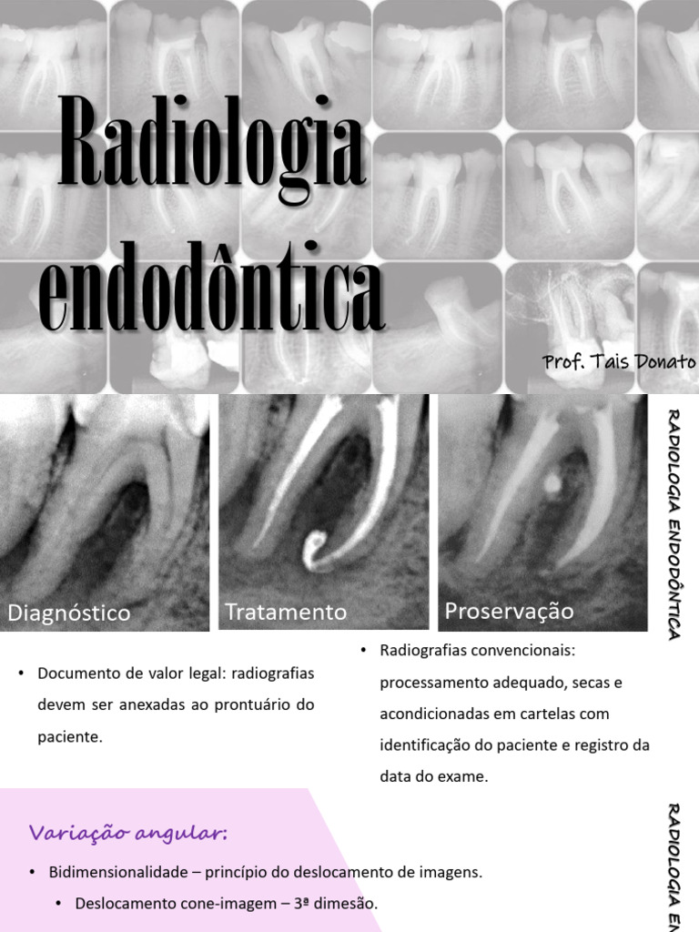 Radiologia+endod%C3%B4ntica | PDF | Radiologia | Radiografia